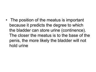 Hypospadias | PPTX