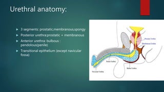Hypospadias.ppt