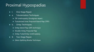 Hypospadias.ppt