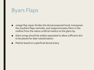 Hypospadias | PPTX