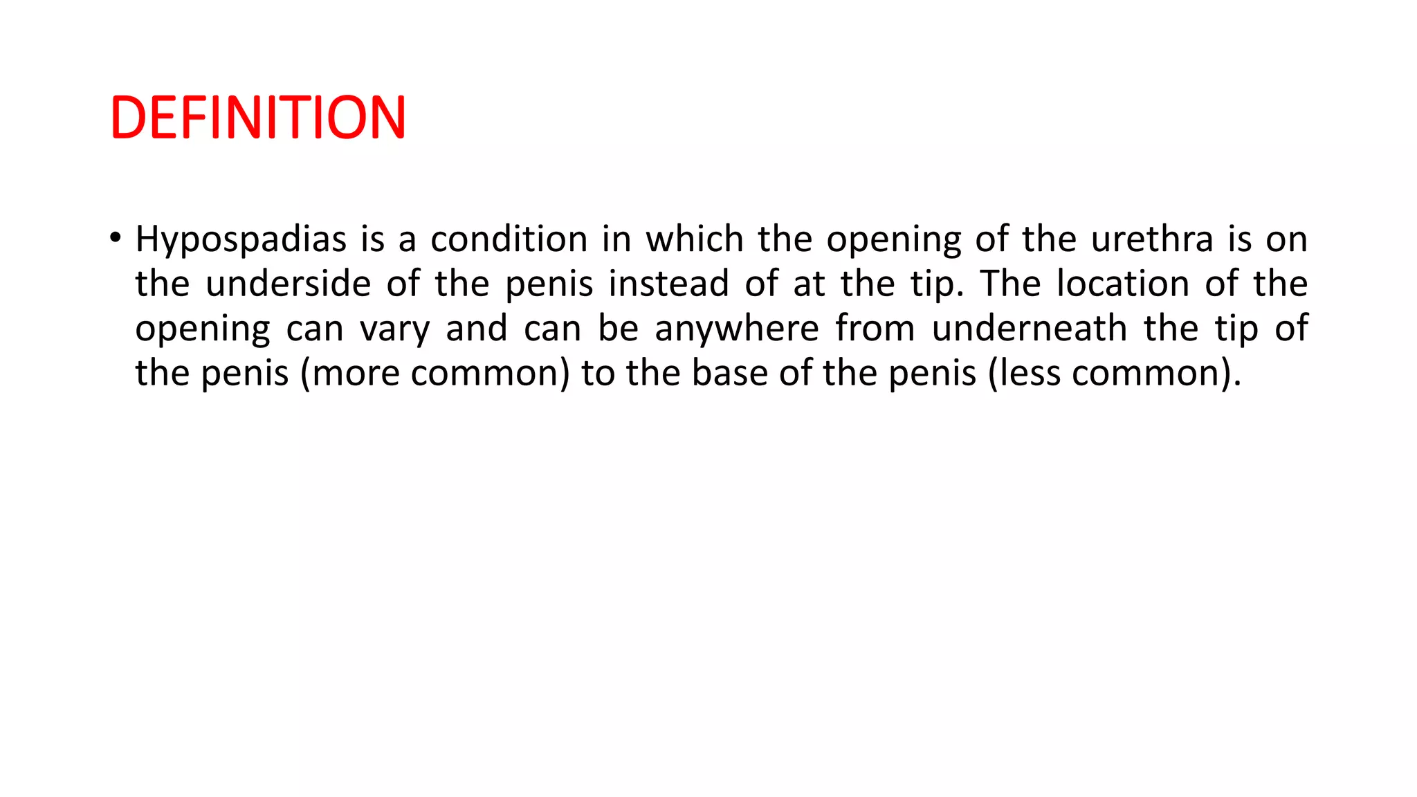 Hypospadias | PPTX