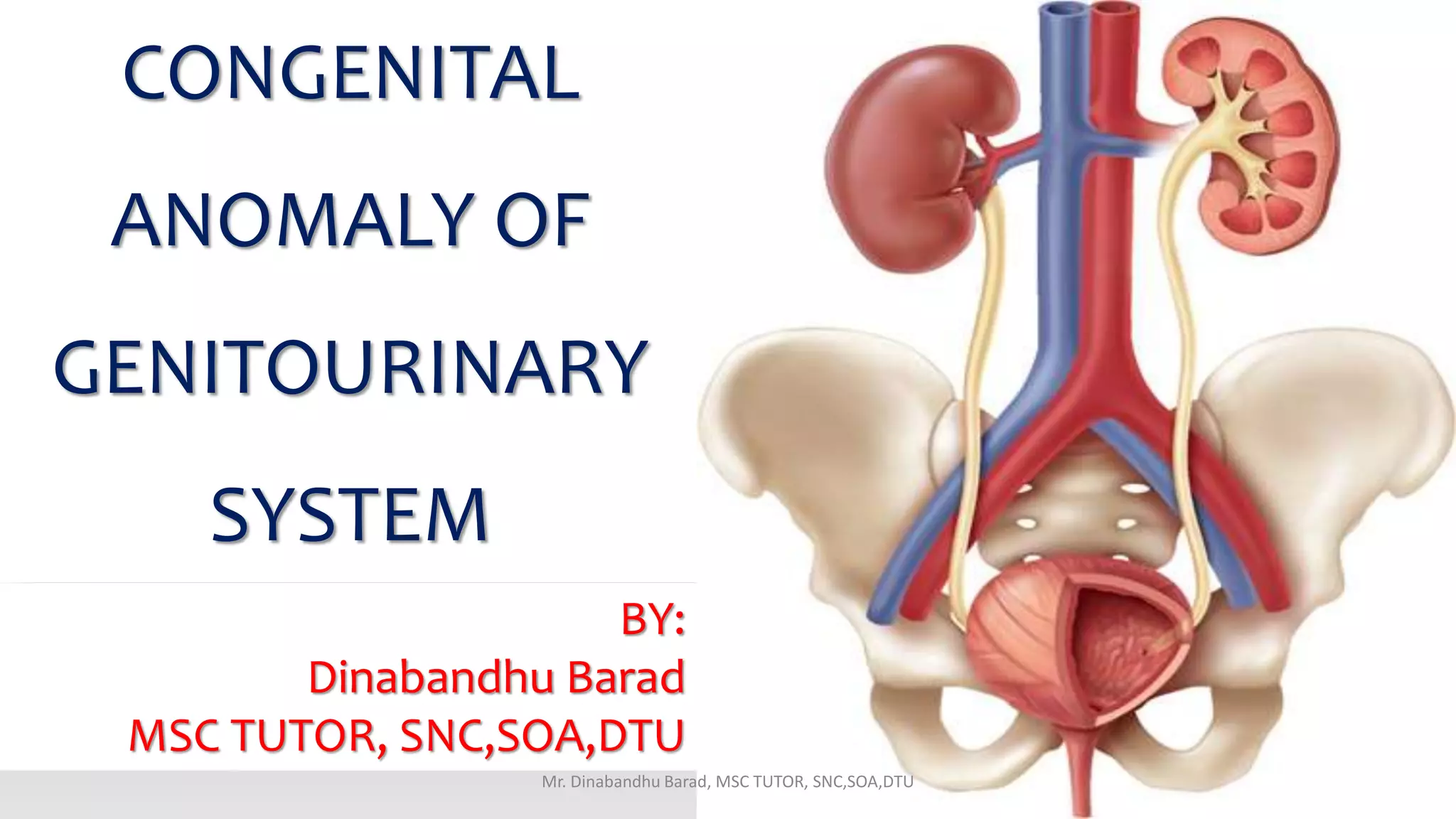 HYPOSPADIAS (CONGENITAL ANOMALY OF GENITOURINARY SYSTEM) | PPTX