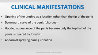 HYPOSPADIAS (CONGENITAL ANOMALY OF GENITOURINARY SYSTEM) | PPTX