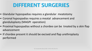 HYPOSPADIAS (CONGENITAL ANOMALY OF GENITOURINARY SYSTEM) | PPTX
