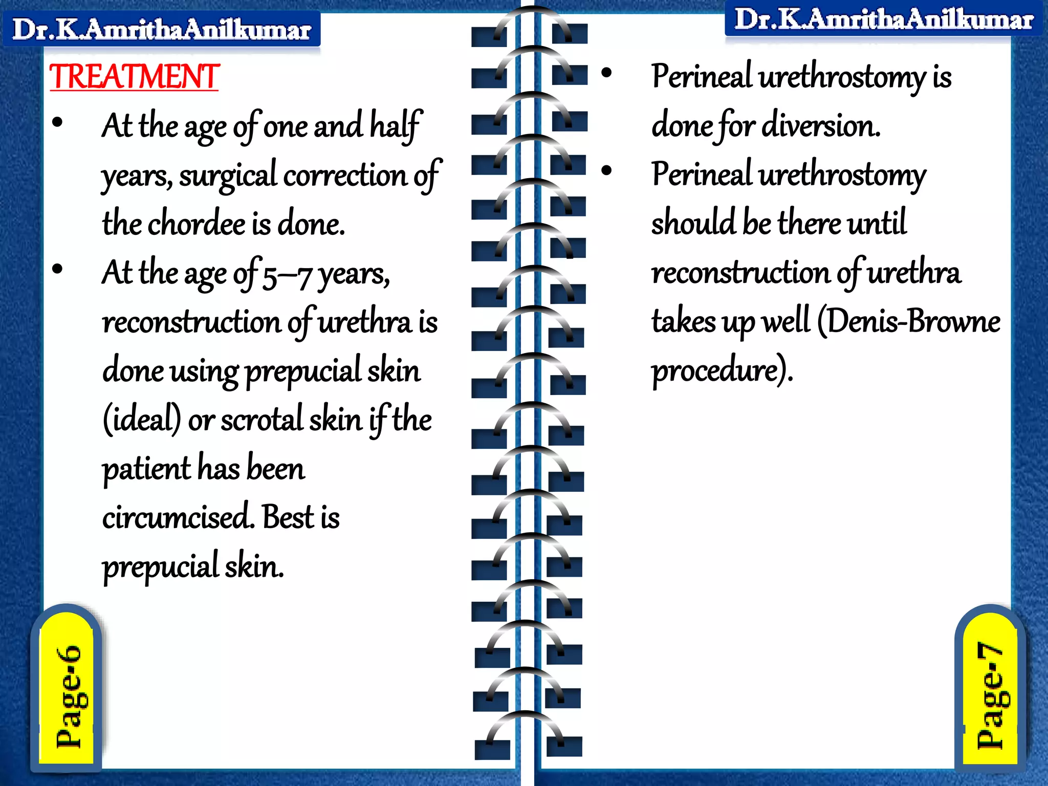 Hypospadias by Dr.K.AmrithaAnilkumar | PPTX