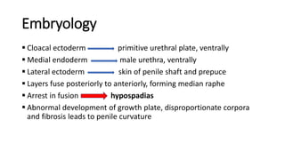 Hypospadias.pptx