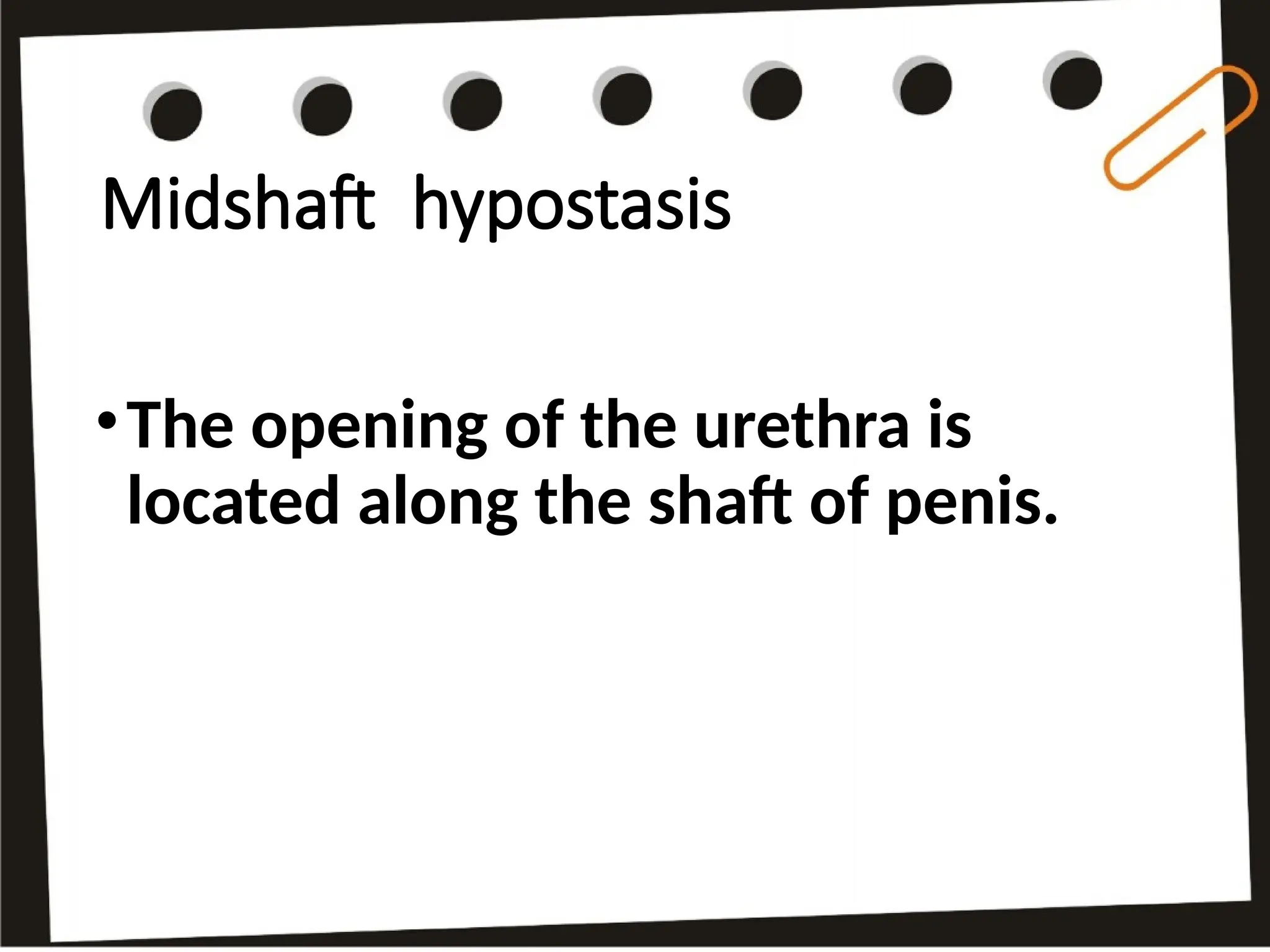 Hypospadias included topics are INCLUDED TOPIC IS DEFINITION, CAUSES ...