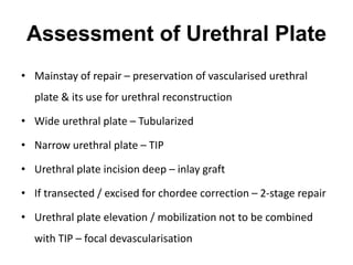 Hypospadias - clinical approach | PPTX | Sexual Conditions | Sexual Health