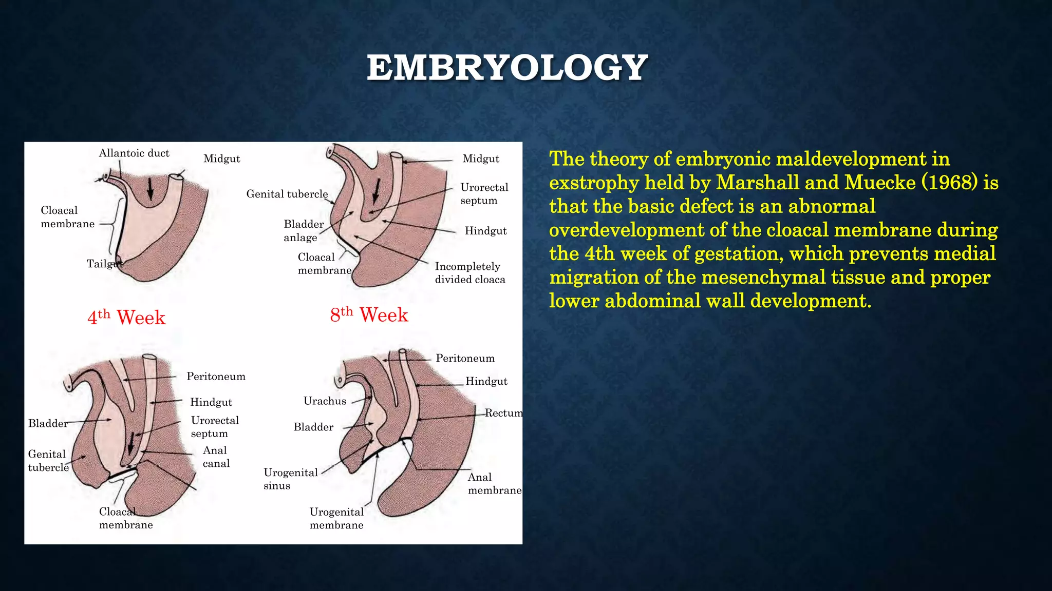 Hypospadias, epispadias and bladder exstrophy | PPTX