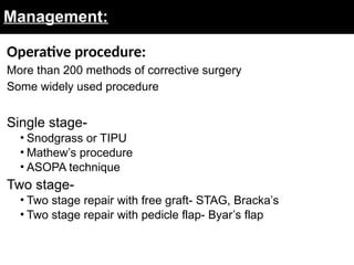 Hypospadias and It's diversity of treatment- Dr. Rafiul.pptx