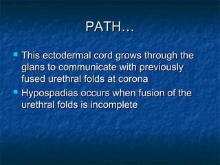 Hypospadias alex. | PPT