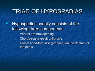 Hypospadias alex. | PPT