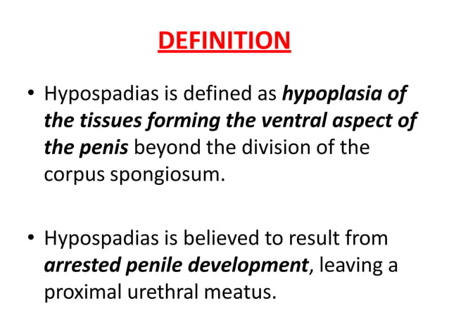 hypospadias and epispadius.pptx