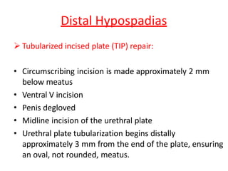 hypospadias and epispadius.pptx