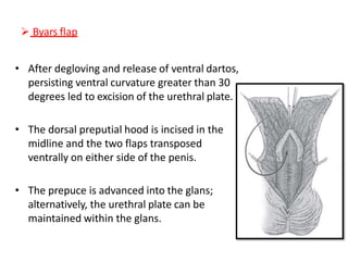 hypospadias and epispadius.pptx
