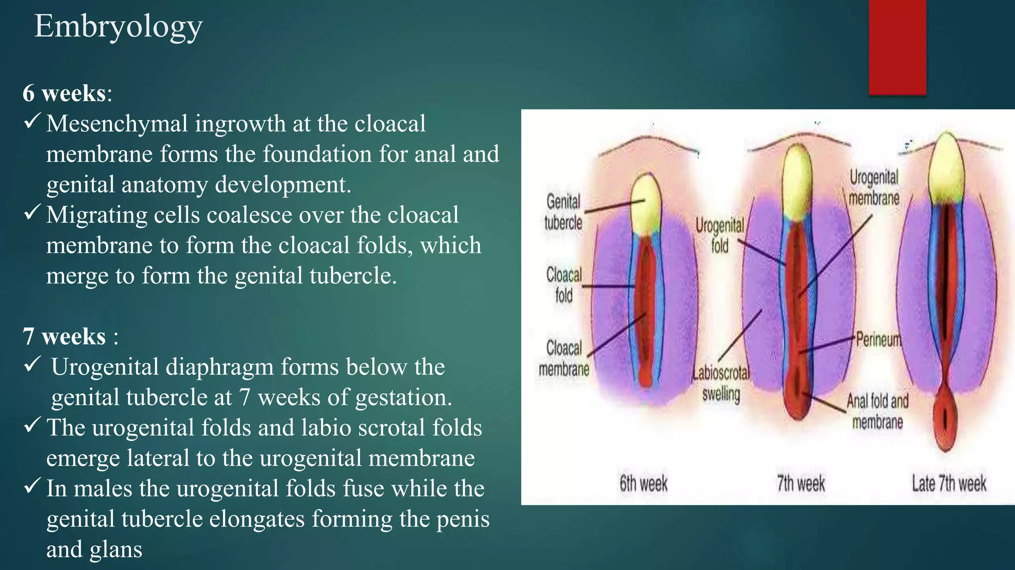 Hypospadias cripple - Staged reconstruction | PPT