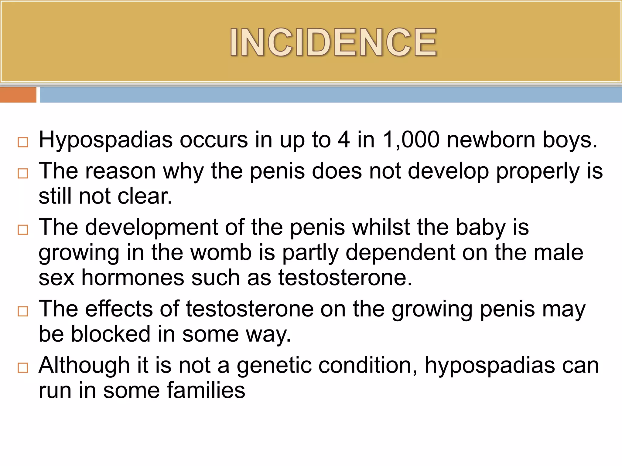 Hypospadias & epispadias | PPTX