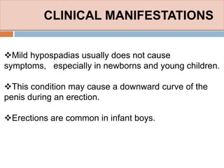 Hypospadias & epispadias | PPTX