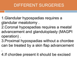 Hypospadias & epispadias | PPTX