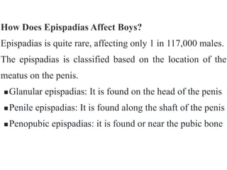 Hypospadias & epispadiasis | PDF