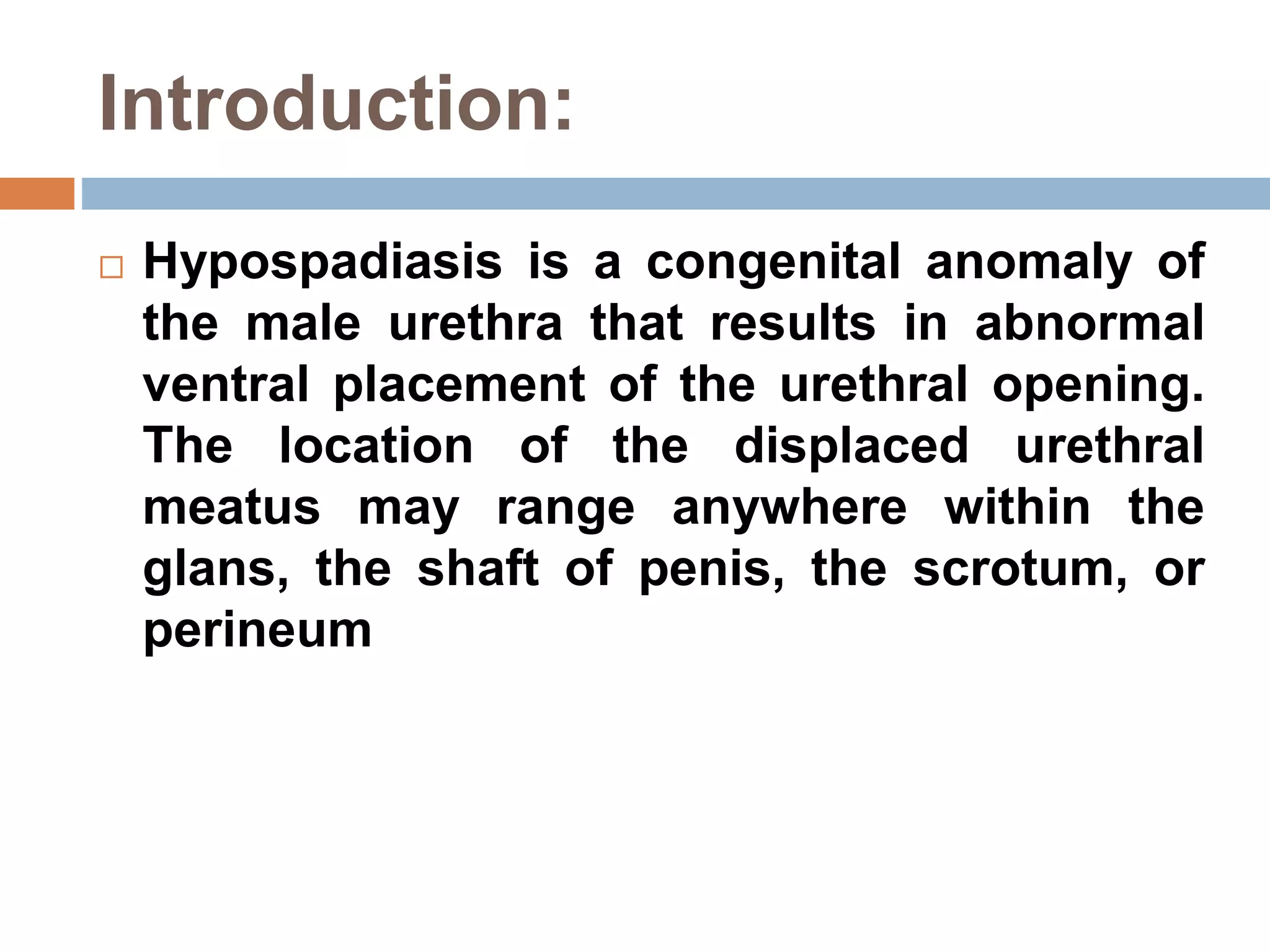 Hypospadiasis | PPTX
