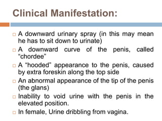 Hypospadiasis | PPTX