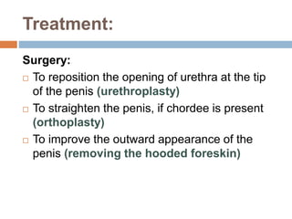 Hypospadiasis | PPTX