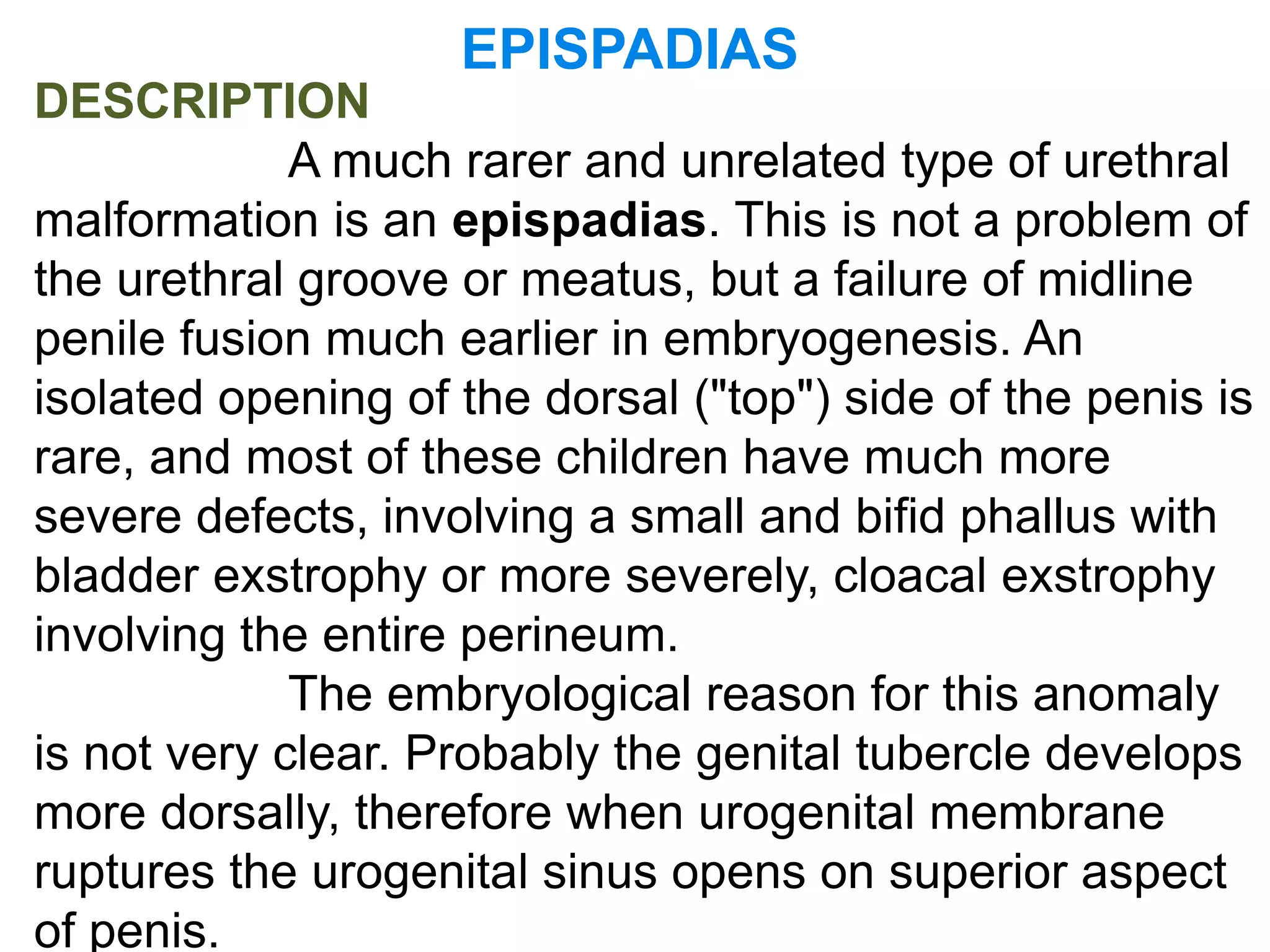 Nursing Management of Patient with Hypospadiasis & epispadias | PPT