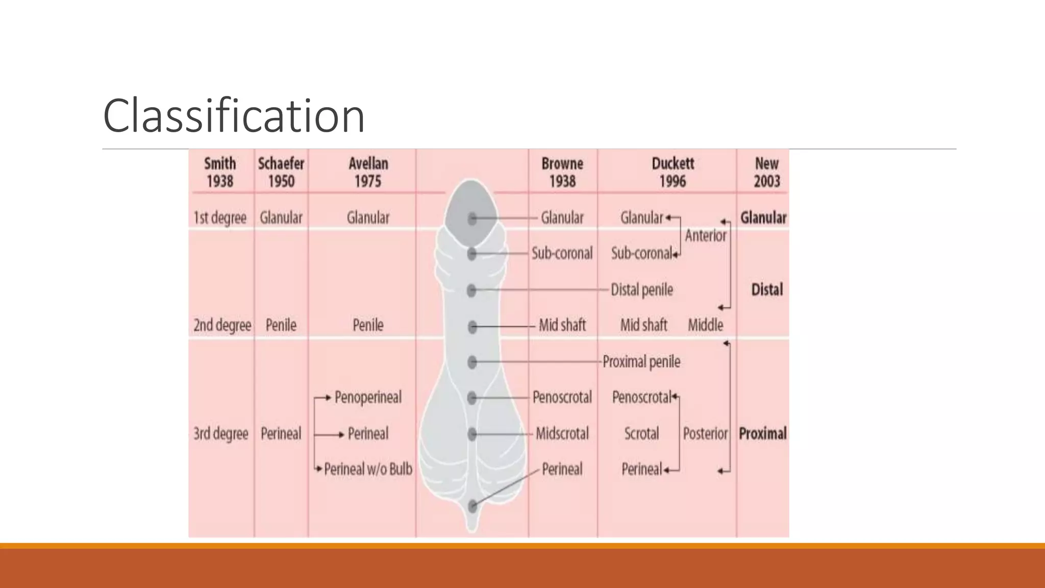 Hypospadias ppt. | PPTX