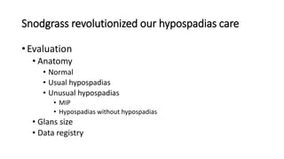 Hypospadias Surgery evolution-2.pptx
