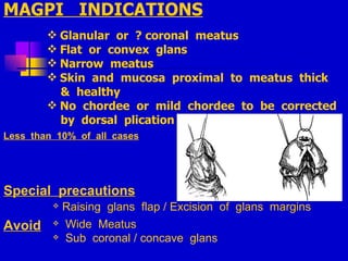 Hypospadias Surgery ,How To Avoid Complications | PPT