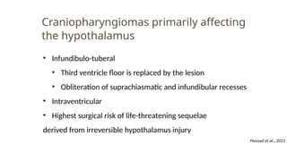 Hypothalamic Syndrome in Neurosurgical Practice | PPTX