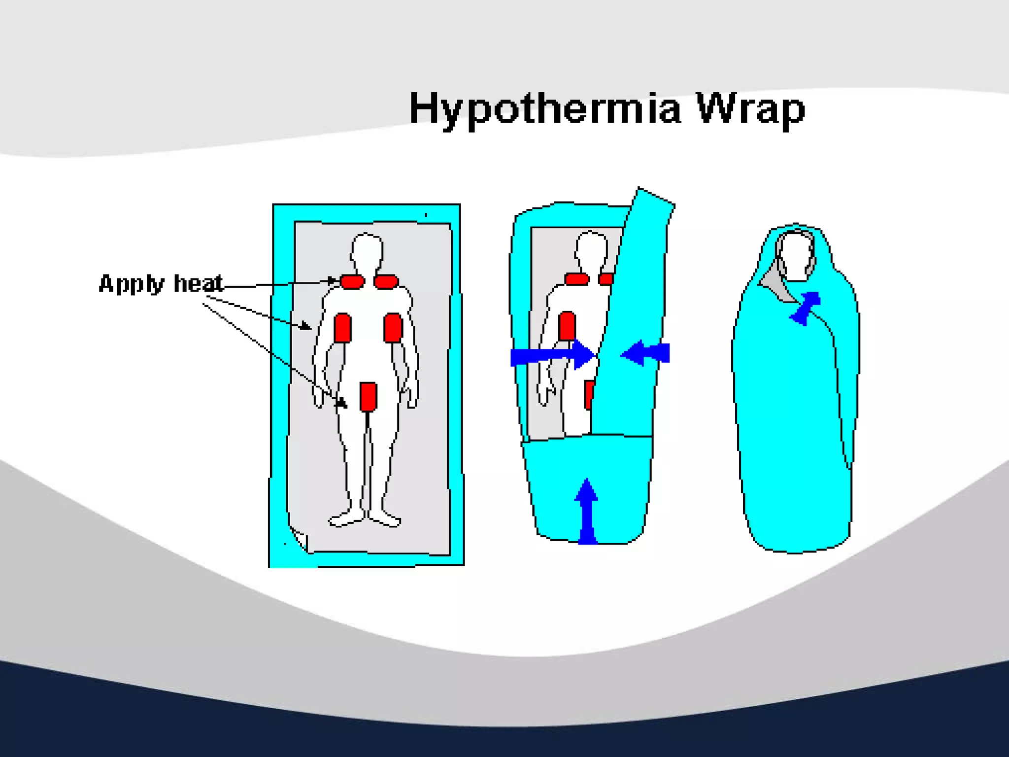 Hypothermia | PPT