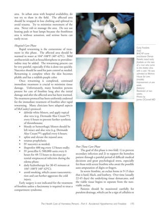 Hypothermia and Frostbite in Homeless Populations | PDF | Injuries ...