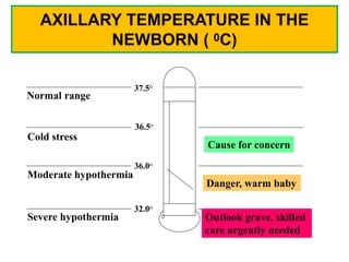 Hypothermia | PPT