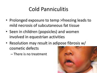 Hypothermia and cold injuries | PPT