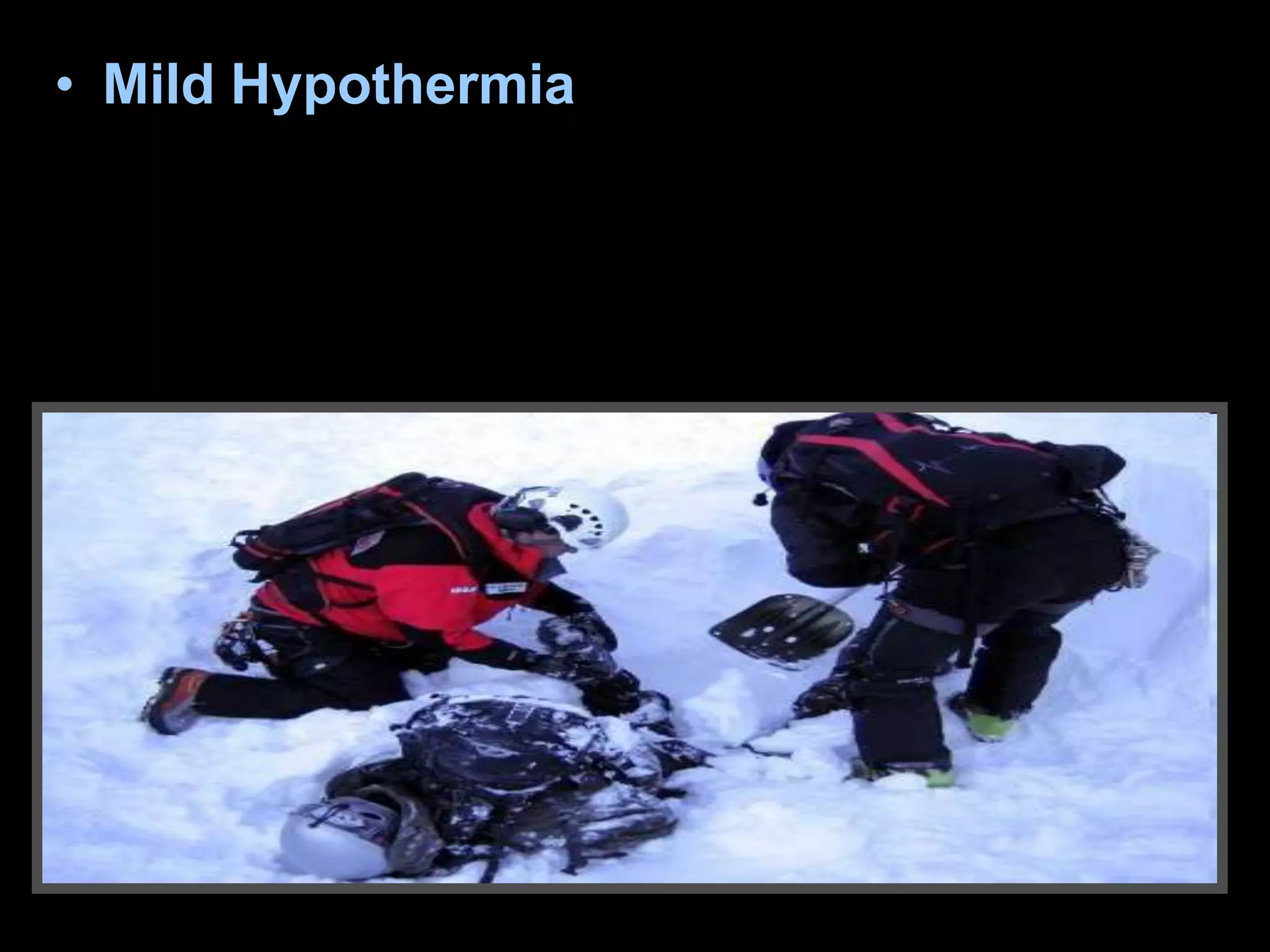 Hypothermia and Hyperthemia Lesson PowerPoint, Thermoregulation | PPTX