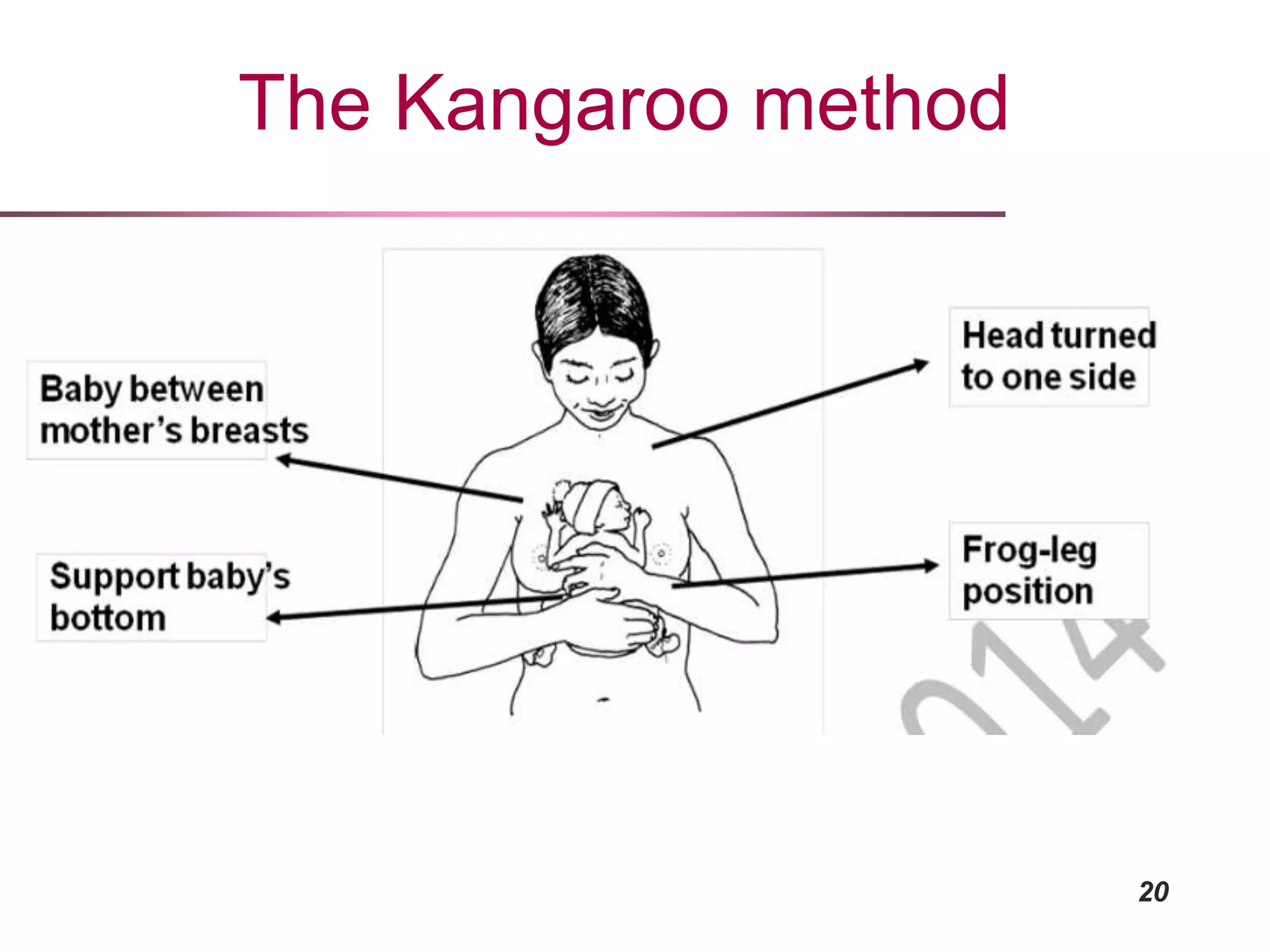Hypothermia in newborn | PPSX