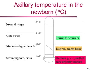 Hypothermia in newborn | PPSX