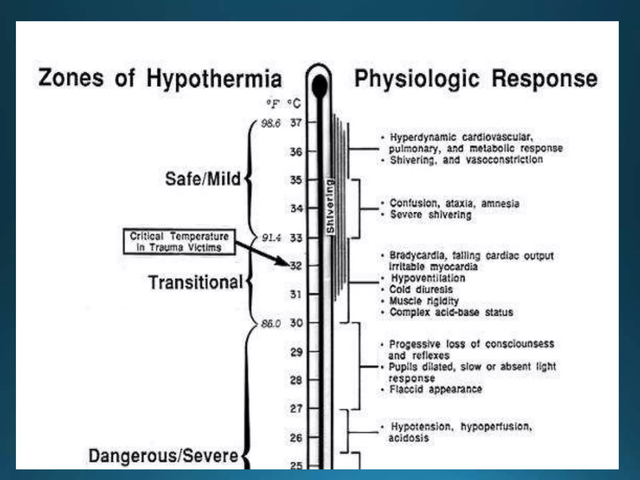 Hypothermia in Trauma Victims:- complication and its prevention | PPTX