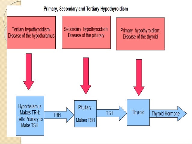 Hypothyroidism