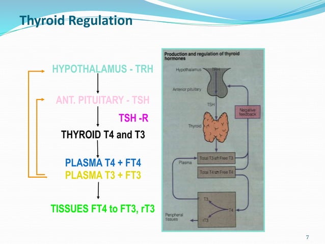 Hypothyroidism | PPTX | Thyroid Disorders | Endocrine and Metabolic Diseases