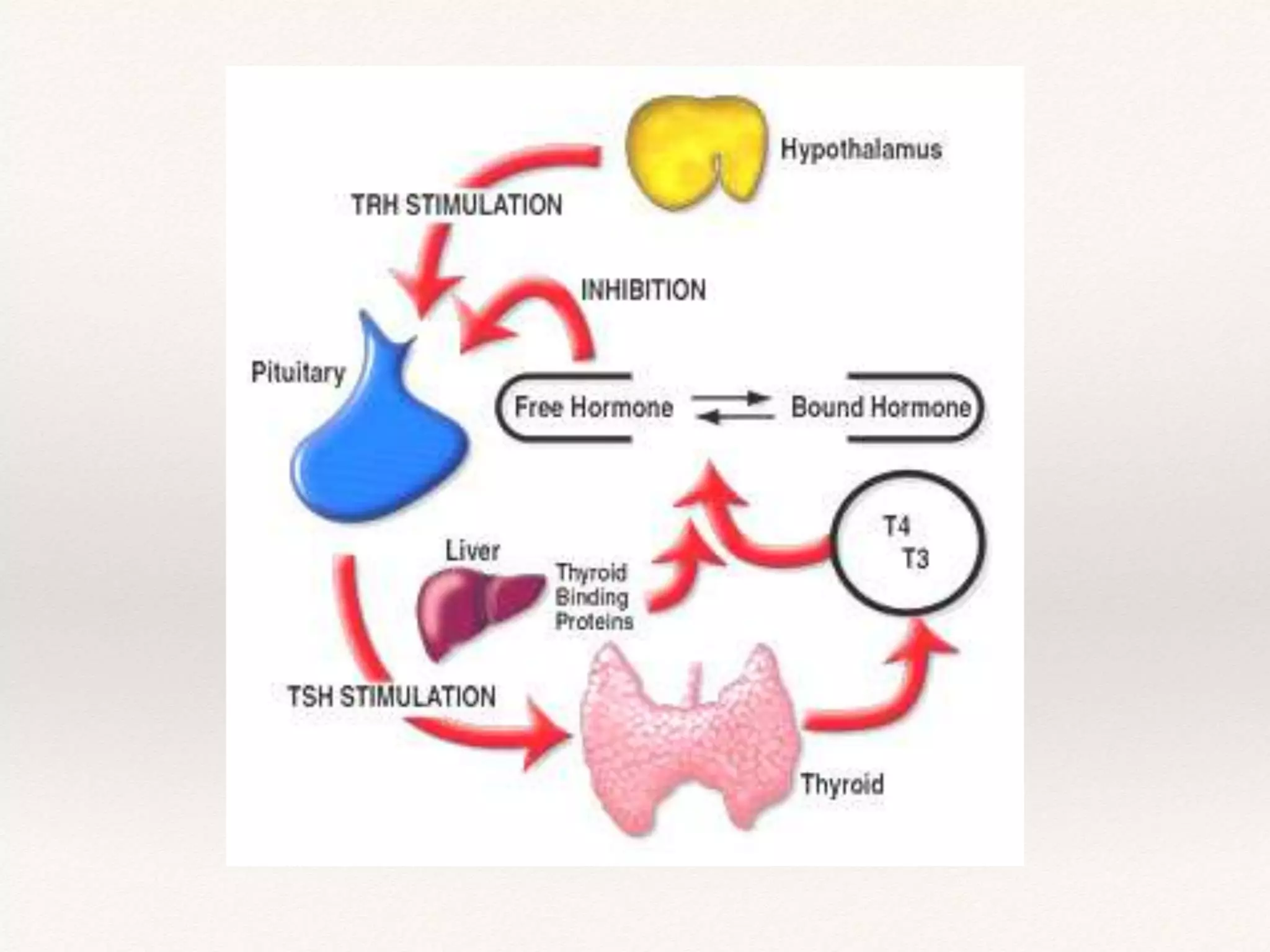 Hypothyroidism | PPTX