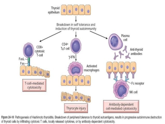 Hypothyroidism Mechanism