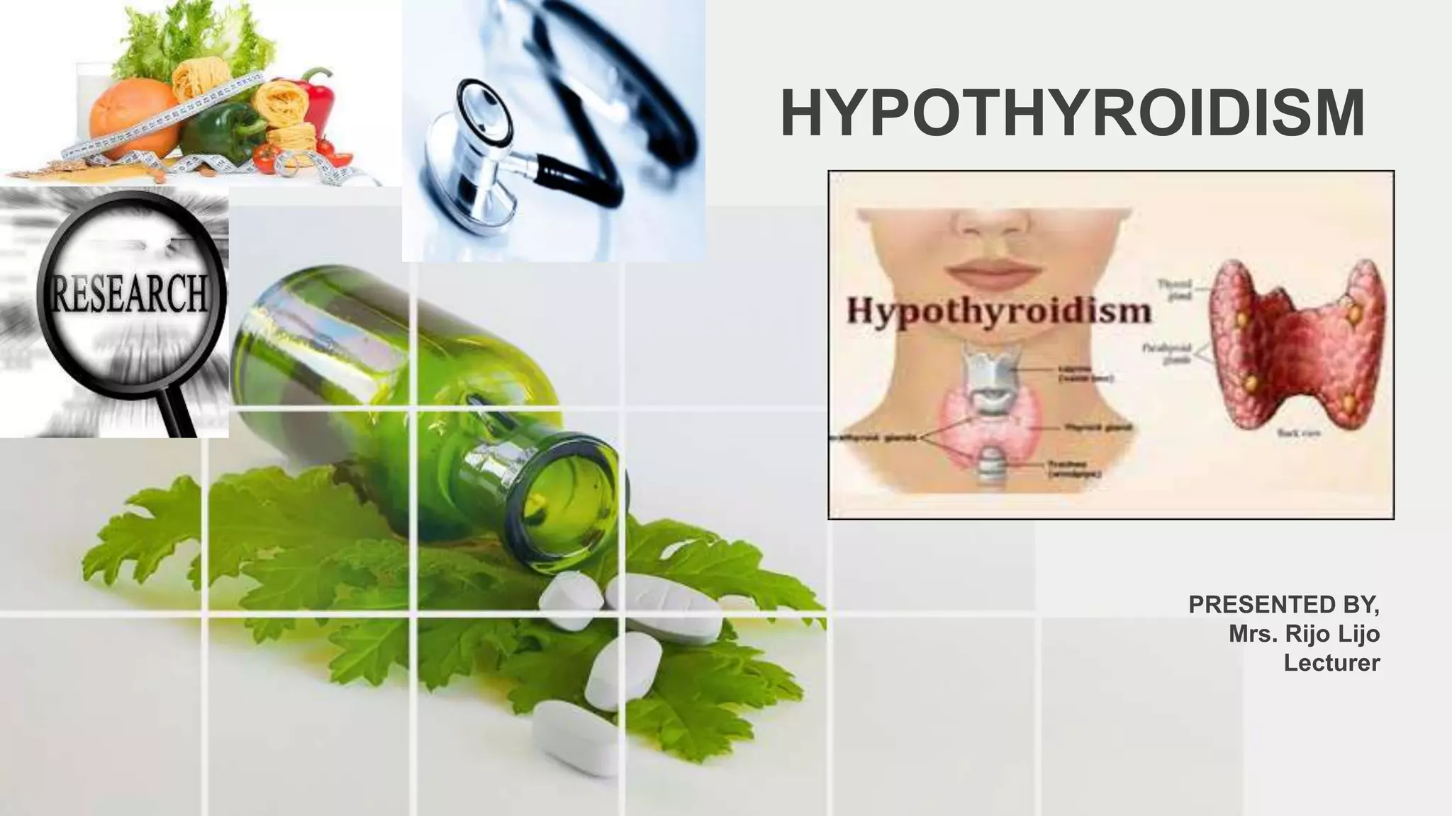 Hypothyroidism | PPTX