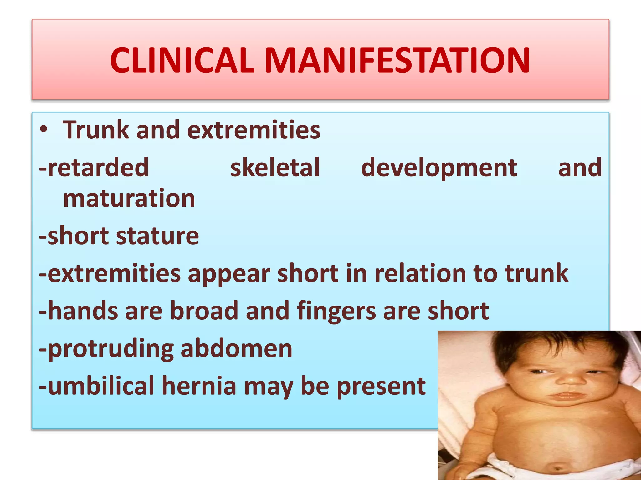 Hypothyroidism in children | PPTX