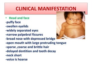 Hypothyroidism in children | PPTX