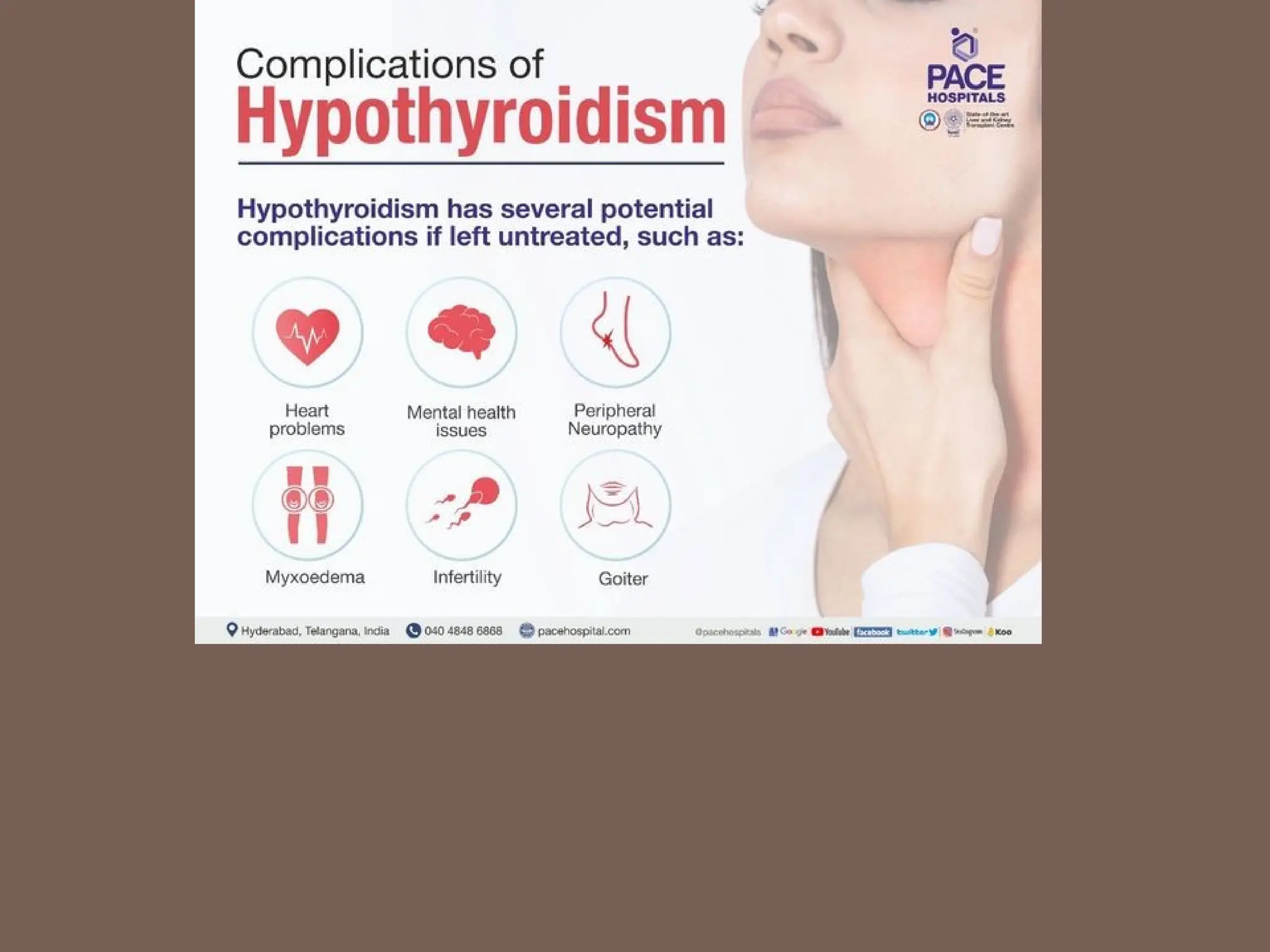 Hypothyroidism - 2024 basic slides for doctor pptx | PPT