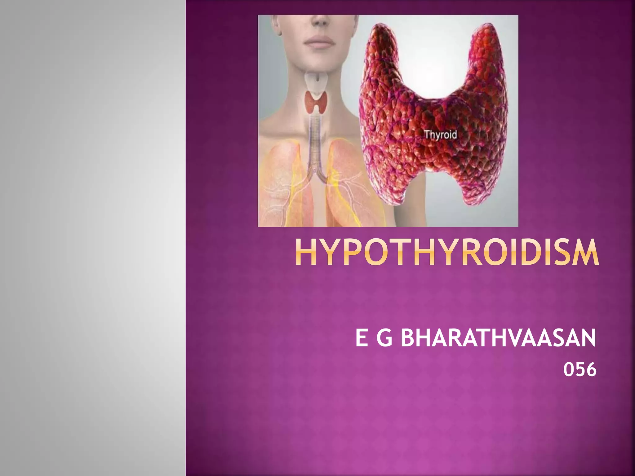 Hypothyroidism | PPTX