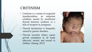 Hypothyroidism.pdf